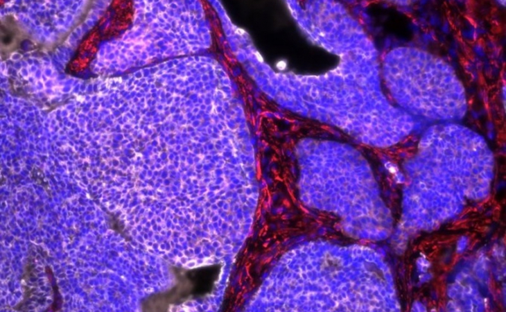 Noticia - Diseñan nanopartículas eficaces en tratamiento y seguimiento ... Noticia - Diseñan nanopartículas eficaces en tratamiento y seguimiento ...